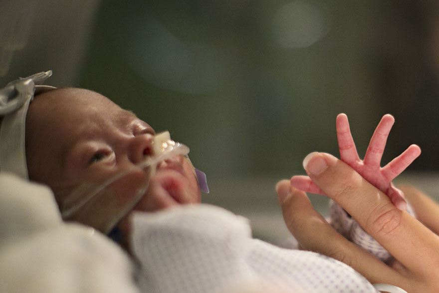 Neonatal Intensive Care Unit - UMC Health System Children's Hospital